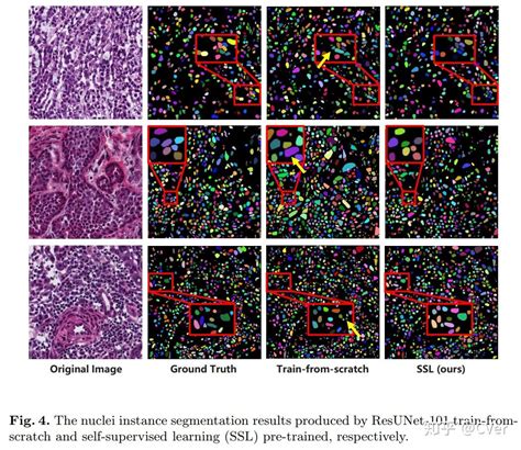 Miccai 2020 用于细胞核分割的实例感知的自监督学习 知乎
