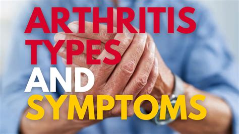 Arthritis Types And Symptoms Geek Consumers