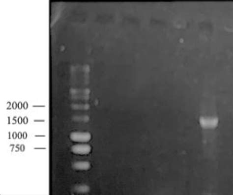 Gel Electrophoresis Showing Approximately 1500 Bp Pcr Amplified Genomic