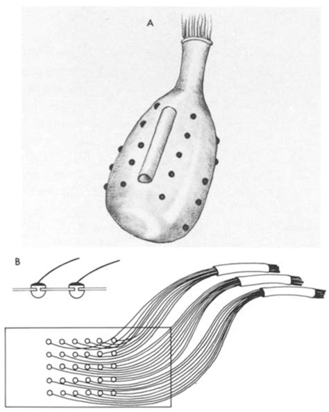 Endocardial Cushion Defects Semantic Scholar
