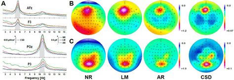 Issues And Considerations For Using The Scalp Surface Laplacian In Eegerp Research A Tutorial