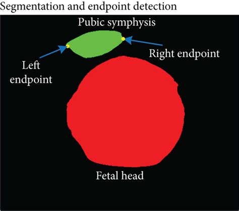 Segmentation And Endpoint Detection Download Scientific Diagram