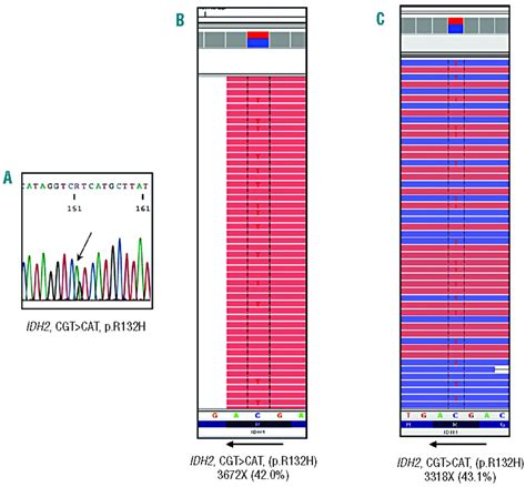 Next Generation Sequencing Based Multigene Mutational Screening For Acute Myeloid Leukemia Using