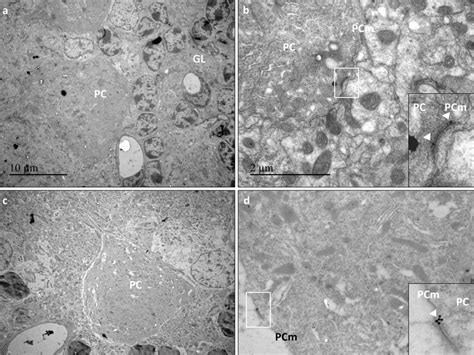 Electron Microscopy Analysis Download Scientific Diagram