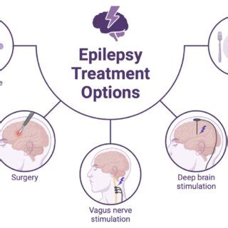 Examples Of Epilepsy Treatment Options Download Scientific Diagram