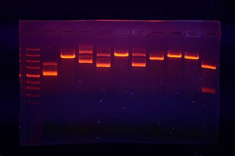 Difference Between Pcr And Rt Pcr Definition Process Application