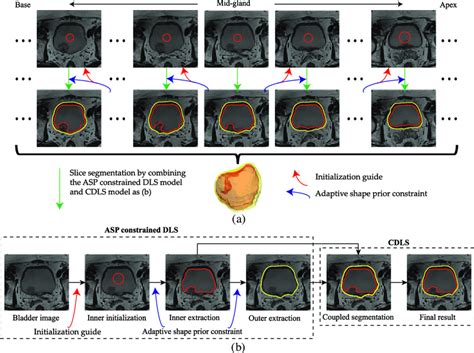 Workflow Of The Proposed Method A Overall Workflow Of 3 D Bladder Download Scientific