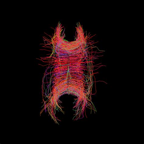 An Introduction To The Probabilistic Tractography Dipy Documentation