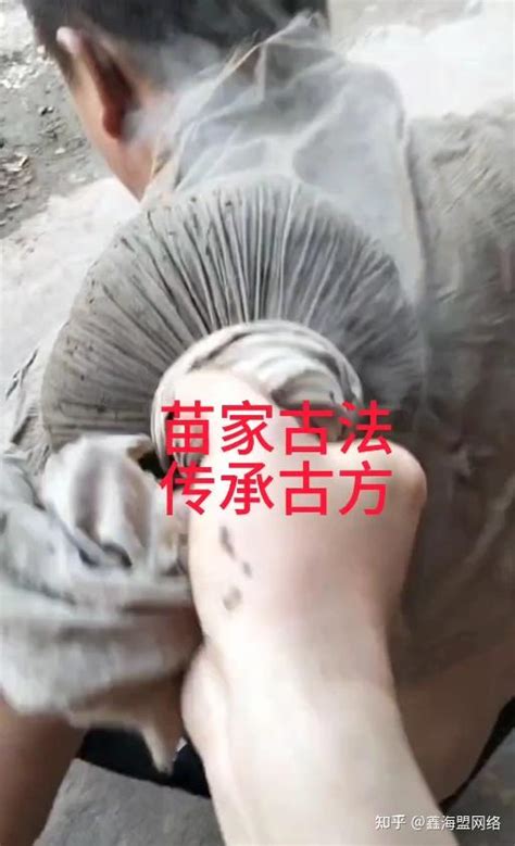 告别肩颈痛关键要治本 知乎