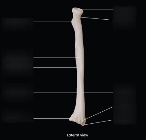 Radius Diagram Quizlet