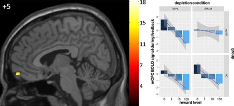 Results Of The Whole Brain Voxelwise Mixed Model Of The Reward Feedback