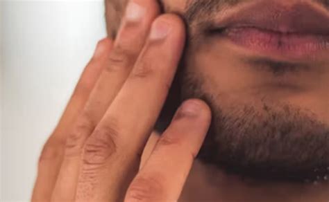 What Is Ingrown Hair Causes Prevention And Treatment Smart Shave
