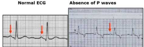 Physiology Of Hypoadrenocorticism Flashcards Quizlet