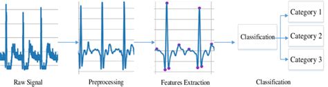 Ecg Signal Processing System Download Scientific Diagram