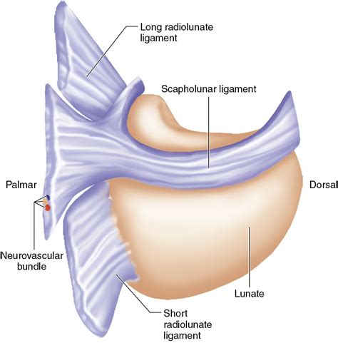 Open Reduction And Fixation Of Acute Lunate Or Perilunate Dislocation With Or Without Fracture