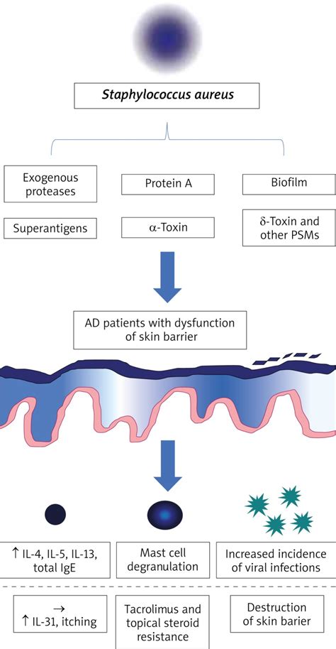 Staphylococcus Aureus An Underestimated Factor In The Pathogenesis Of Atopic Dermatitis Pmc