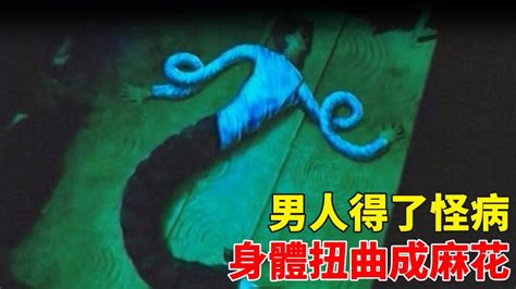 男人得了怪病，眼睛可以像漩渦一樣旋轉，身體一點點擰成麻花！【肥貓說電影】 Youtube