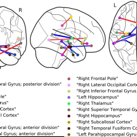 Brain Network Mapping Using Structural Mri S Mri And Functional Mri