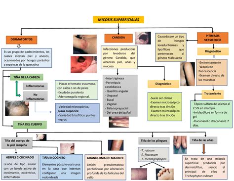Principales Tipos De Micosis Superficiales Esquemas Y Mapas