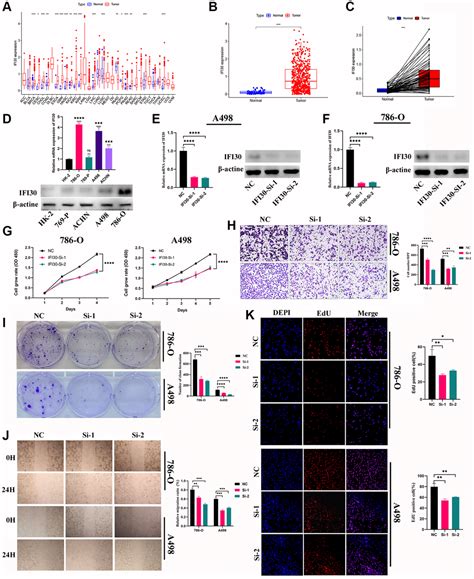 Identification And Validation Of A Novel Signature Based On Macrophage