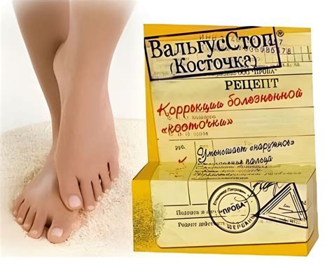 Крем Вальгусстоп (Косточка) для ног: купить, цена, отзывы, обзор