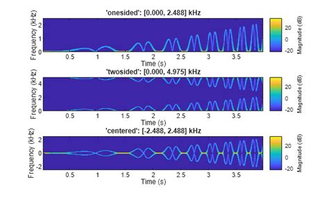 Stft Short Time Fourier Transform Matlab