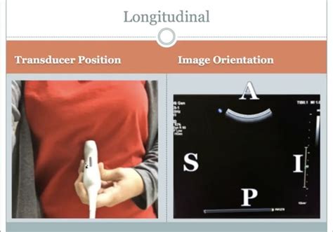 Transducer Orientation Flashcards Quizlet