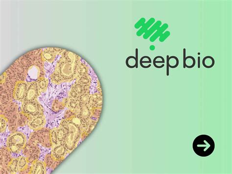 Deep Bios Ai Model For Prostate Cancer Assessment Validated By