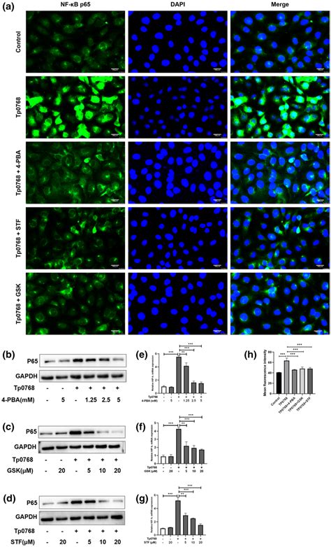 ER stress regulated the activation of the NFκB HIF α pathway a The Download Scientific