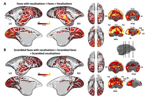 Superadditive Neural Processing Of Multisensory Face And Vocal Signals Download Scientific