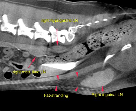 Ct Mast Cell With Metastatic Spread To Right Inguinal Lymph Nodes And