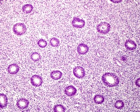 Human Endometrium Light Micrograph Stock Image C051 0105 Science