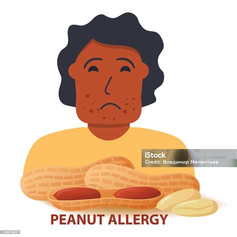 아프리카 계 미국인 남자 너트 알레르기 증상 문제 부풀어 오른 남자 캐릭터 개념에 대한 스톡 벡터 아트 및 기타 이미지 개념 건강관리와 의술 건강한 생활방식 Istock