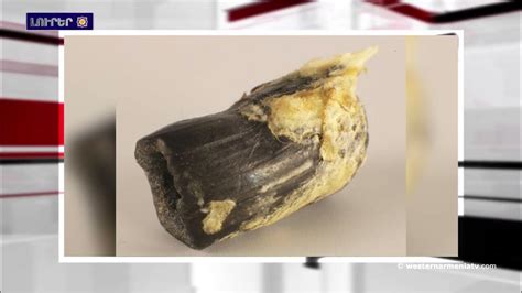 Թիւրքական փամփուշտը՝ հայ կնոջ մարմնին մէջ Youtube