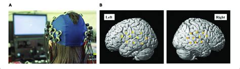 A The Photograph Of The Optode Array Placed On The Head Of One Of