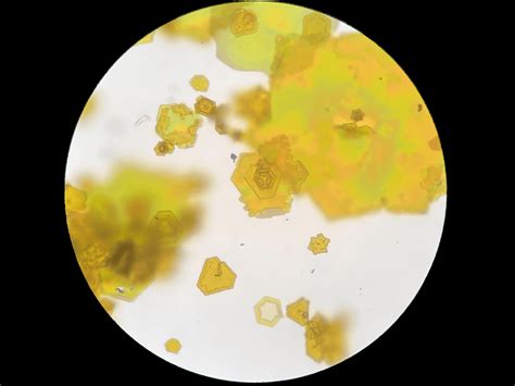 Lead Iodide Crystals Under A Microscope R Chemistry