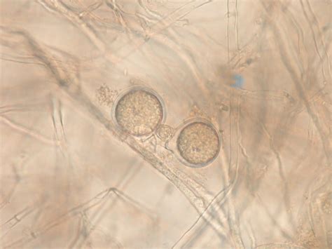 Phytophthora Of Tree Fruit Purdue University Facts For Fancy Fruit