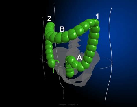 Colon 3d Colon Explorer