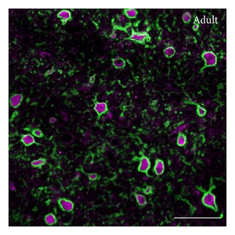 Perineuronal Nets In The Developing Cerebellar Nucleus Perineuronal Download Scientific