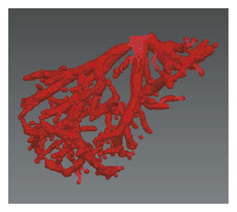 Comparison Of The Improved Fuzzy Connectedness Fc Method With