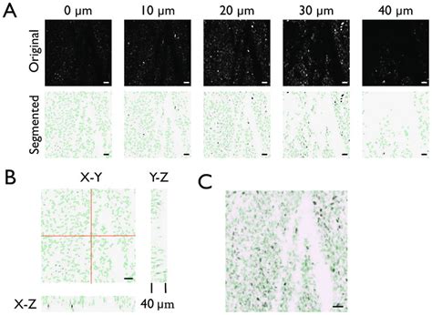 cell segmentation on a high cell density z stack a representative