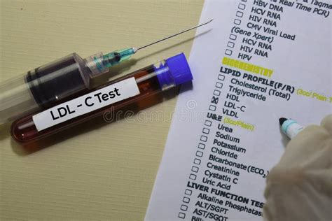 LDL C Test With Blood Sample Top View Isolated On Office Desk Stock Photo Image Of Artery