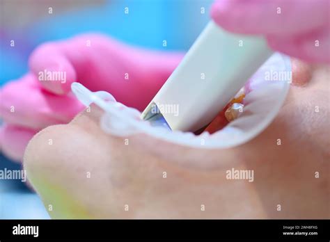 Woman Dentist In Pink Gloves Using Dental Intraoral Scanner While Examining Patient Teeth In