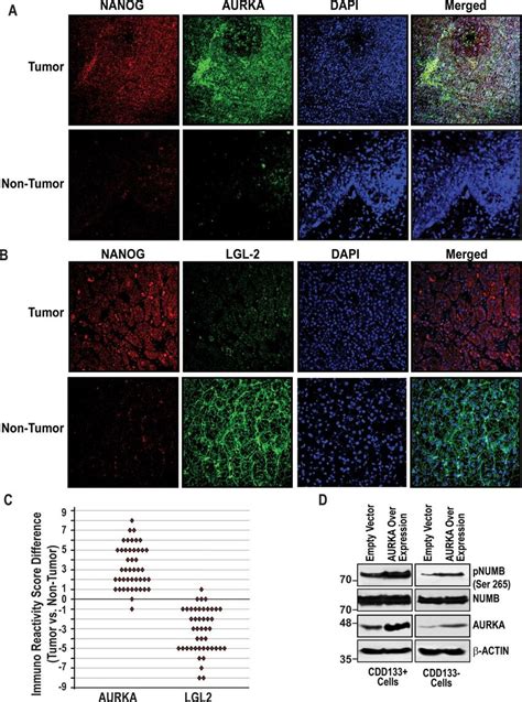 Validation Of Aurka And Lgl 2 Expression In Clinical Samples A And B