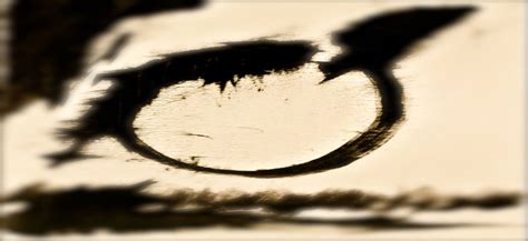 Edorium Journals Article Title Repeated Cholestyramine Washouts In A Pregnant Patient On