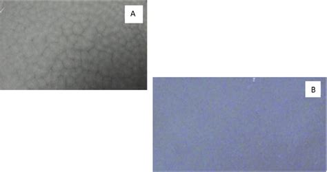5 Wt Pvczno Nanocomposite A Untreated Zno B Treated Zno