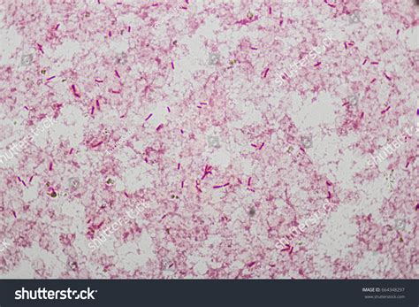 Pseudomonas Aeruginosa Gram Negative 114 รายการ ภาพ ภาพสต็อกและเวกเตอร์