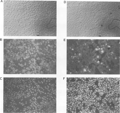 Immunofluorescence Microscopy Yeast Cells Yvb110 [a To C] And Yvb110