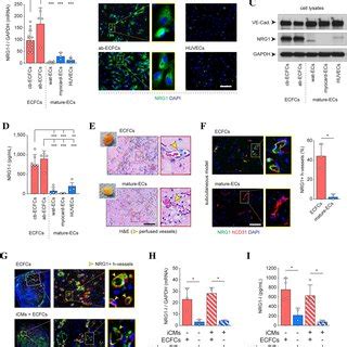 Transcriptional Analysis Of ECFCs And Mature ECs A Venn Diagram With Download Scientific