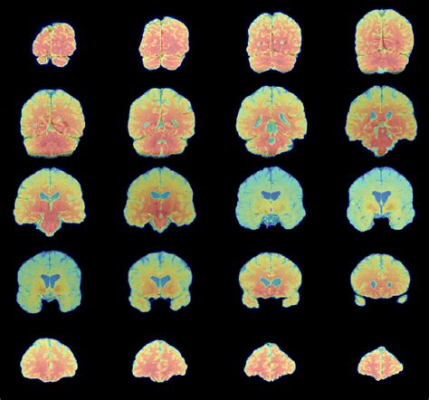 Results Are Flipped When Using Ants Apply Transforms · Issue 422 · Antsx Antspy · Github